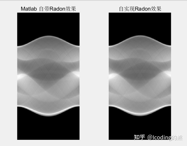 Radon变化的matlab实现 - 知乎