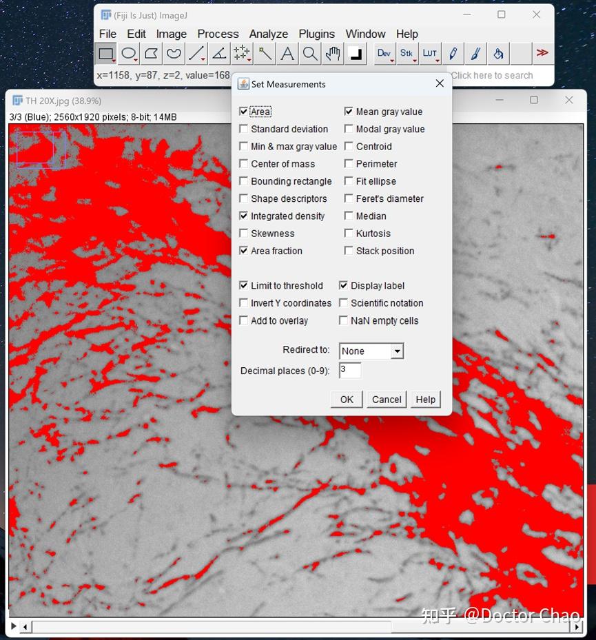 组化片子如何利用Image J 进行阳性信号面积占比统计分析 - 知乎