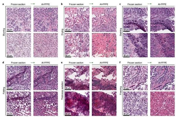 Nat Biomed Eng | 将组织图像从冷冻切片转变为FFPE的深度学习模型 - 知乎