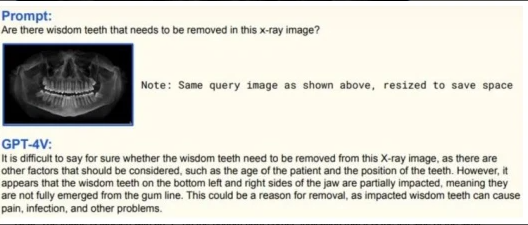 GPT-4V：AI在医疗领域的应用 - 知乎