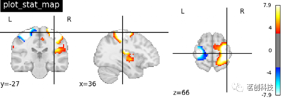 Nilearn：绘制大脑图像 - 知乎