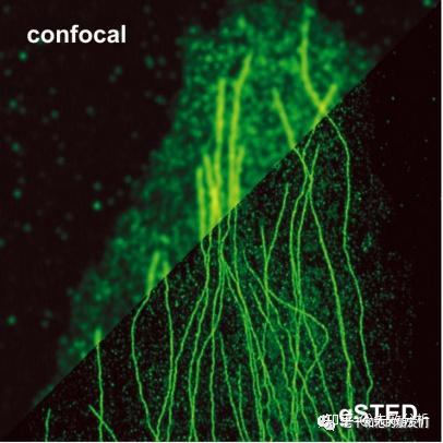 超分辨显微术：打破Abbe衍射极限的桎梏 - 知乎