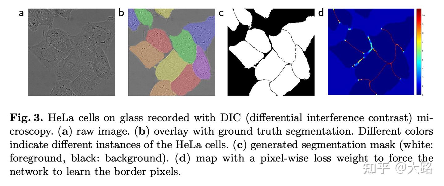U-Net: Convolutional Networks for Biomedical Image Segmentation论文阅读 - 知乎