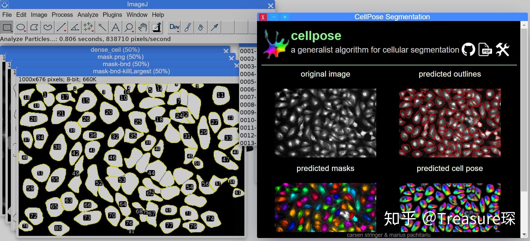 ImageJ实用教程——网页版ImageJ - 知乎