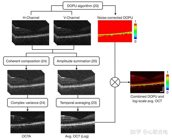 Quant Imaging Med Surg：多尺度、多对比度、无传感器的自适应光学OCT成像 - 知乎