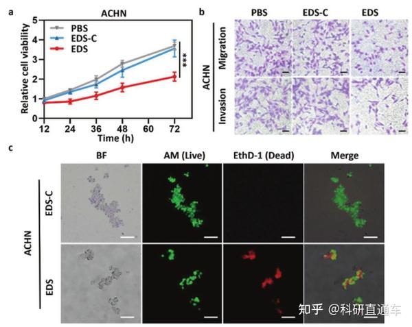 研究前沿｜逆转耐药 提高化疗敏感性！Adv. Mater：可转化的ECM剥夺系统有效抑制肾细胞癌 - 知乎