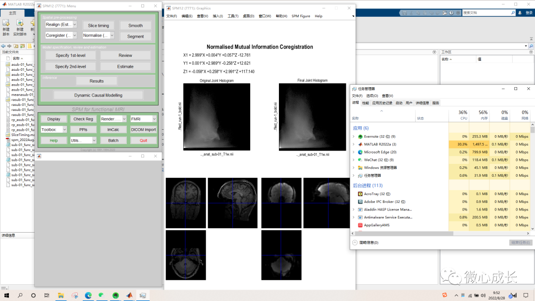 如何用SPM完成fMRI数据的预处理【任务态】 - 知乎