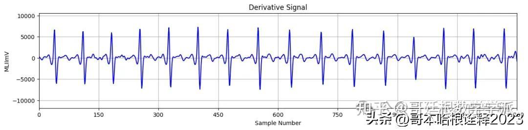 心电信号ECG处理分析（滤波降噪，QRS波检测等，Python） - 知乎