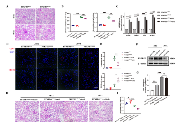 Cell Death Dis︱洪权教授课题组揭示IGFBP5在糖尿病肾脏病进展中的作用机制 - 知乎