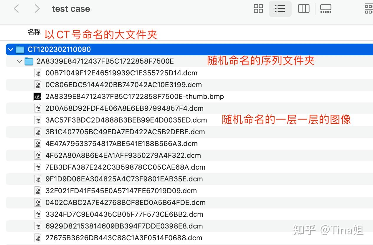 数据预处理- sort 乱序DICOM 文件 - 知乎