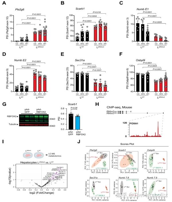 代谢学人--Nature Metabolism：胆固醇代谢紊乱，RBFOX2来理清 - 知乎