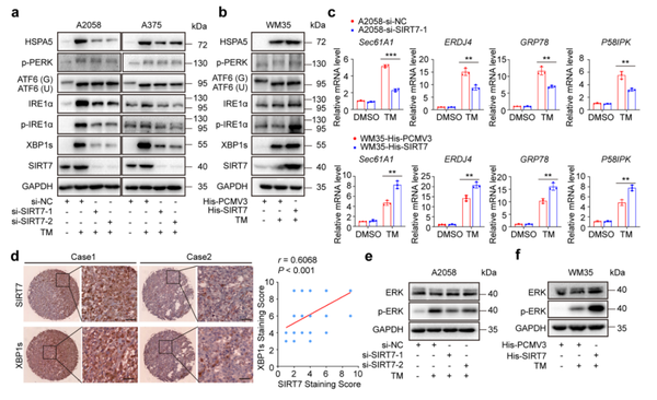 STTT︱空军军医大学李春英团队揭示长寿基因家族成员SIRT7在黑色素瘤发展和免疫逃逸中的作用和机制 - 知乎