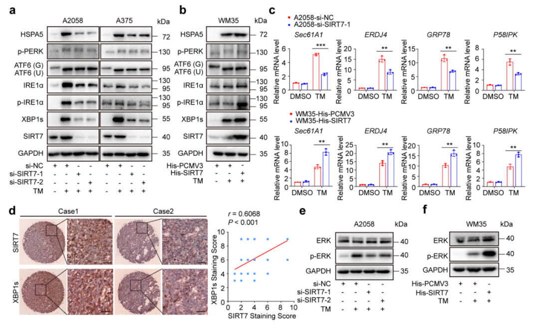 STTT︱空军军医大学李春英团队揭示长寿基因家族成员SIRT7在黑色素瘤发展和免疫逃逸中的作用和机制 - 知乎