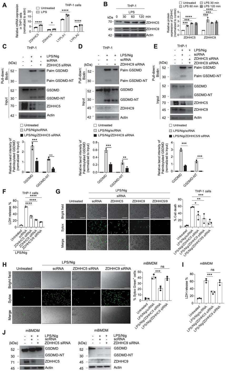 Science Immunology丨GSDMD通过棕榈酰化完成膜移位从而诱导焦亡 - 知乎
