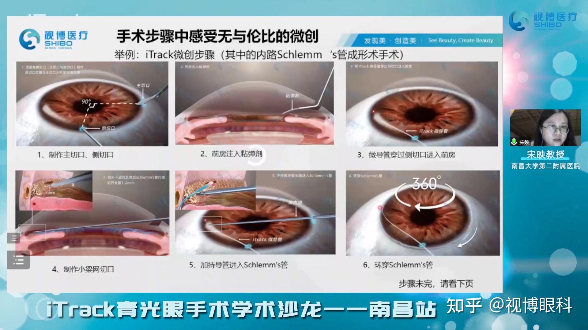 专题回顾 | iTrack 青光眼手术学术沙龙——南昌站 - 知乎