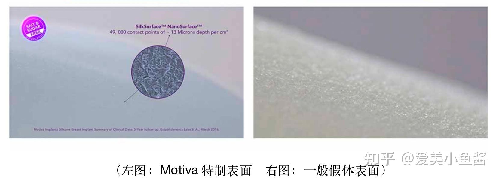 拒绝平庸【Motiva】假体隆胸届的‘爱马仕’！ - 知乎