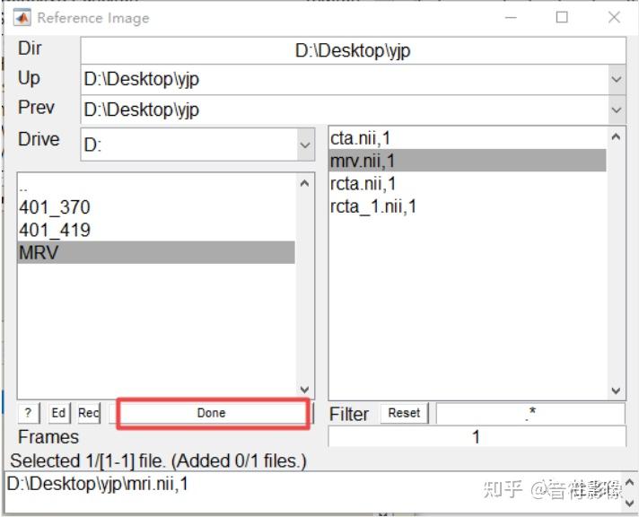 基于SPM的多模态神经影像配准方法 - 知乎