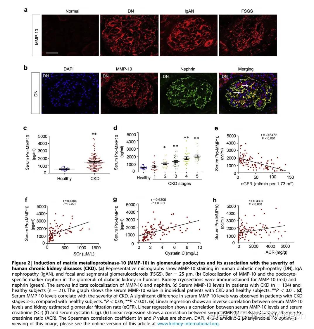 MMP10-新的足细胞损伤介导分子 - 知乎