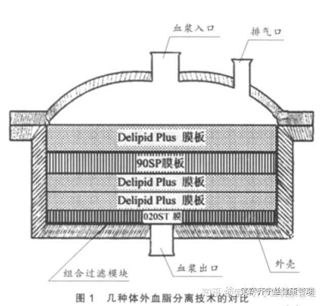 血脂异常新疗法, DELP新型体外血脂分离技术 - 知乎