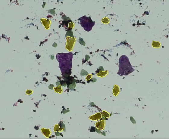 Imagej图像处理实践（ImageJ学习-图像处理 545367350） - 知乎