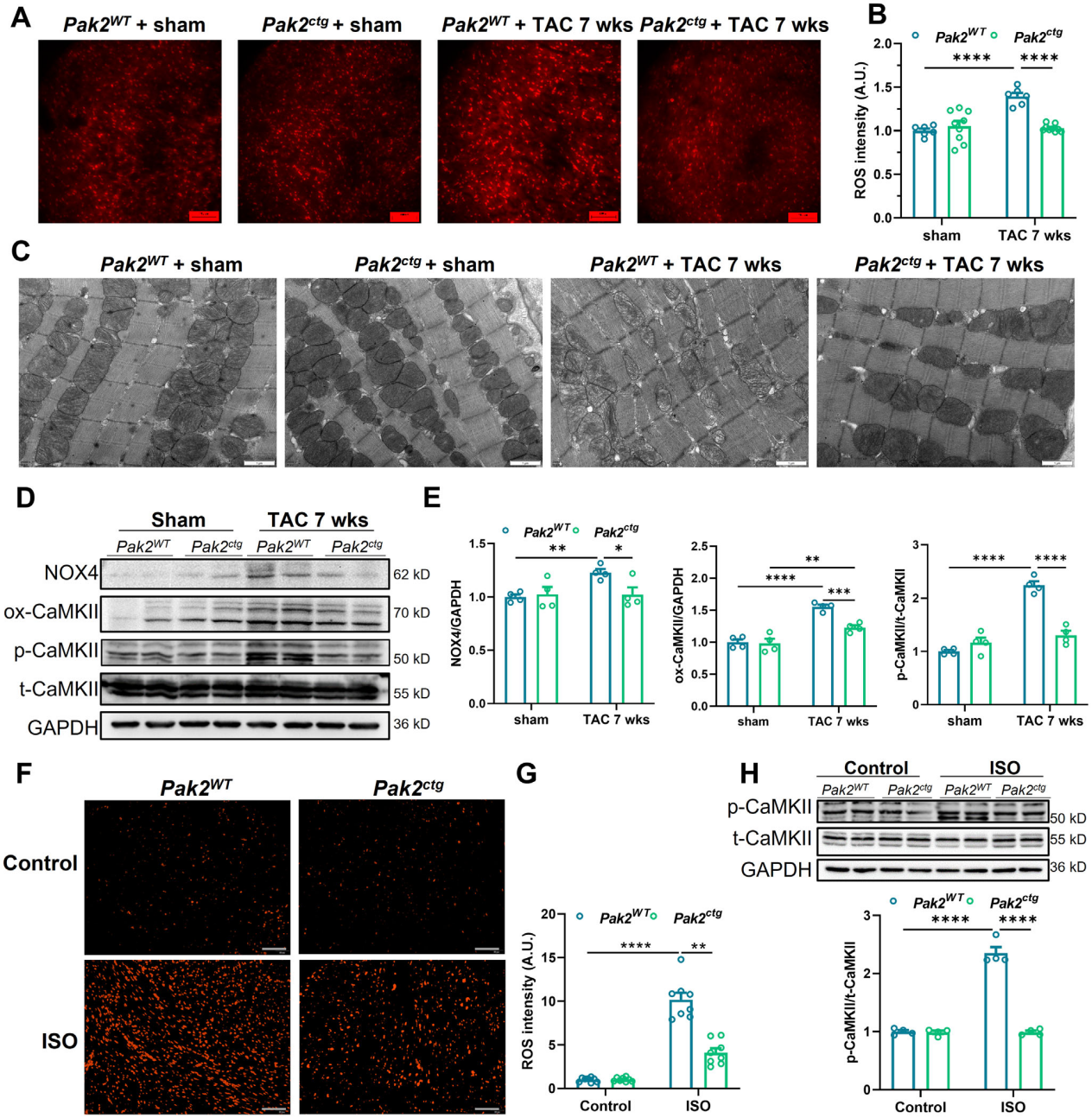 P21活化激酶2（Pak2）作为与心脏肾上腺素能应激和肥厚相关的室性心动过速的新靶点 - 知乎