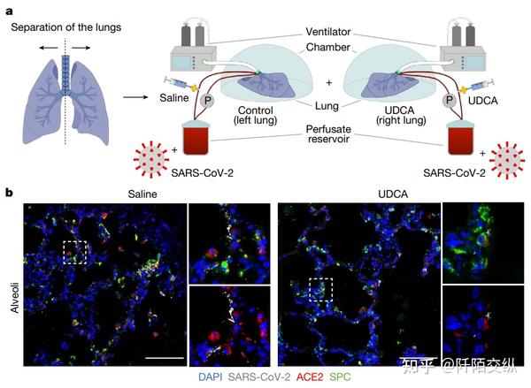 Nature：熊去氧胆酸（UDCA）预防新冠感染，同时预防病毒变异感染 - 知乎