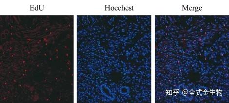 【细胞生物学原创系列十四】EdU作用原理及应用 - 知乎