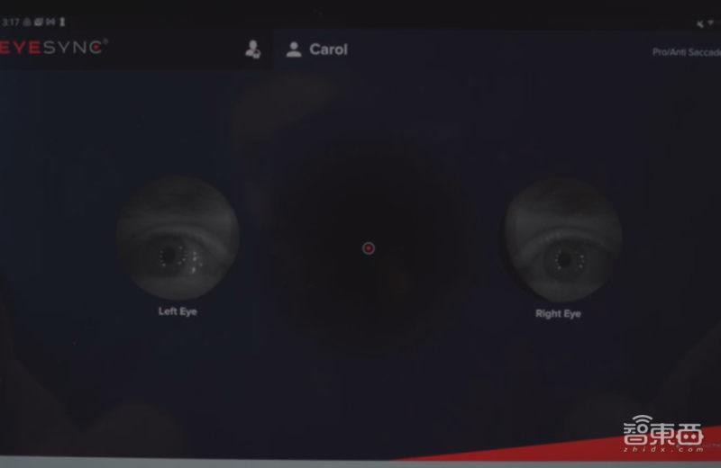 用VR头显检测脑损伤，核心技术获美国欧盟双重认证 - 知乎