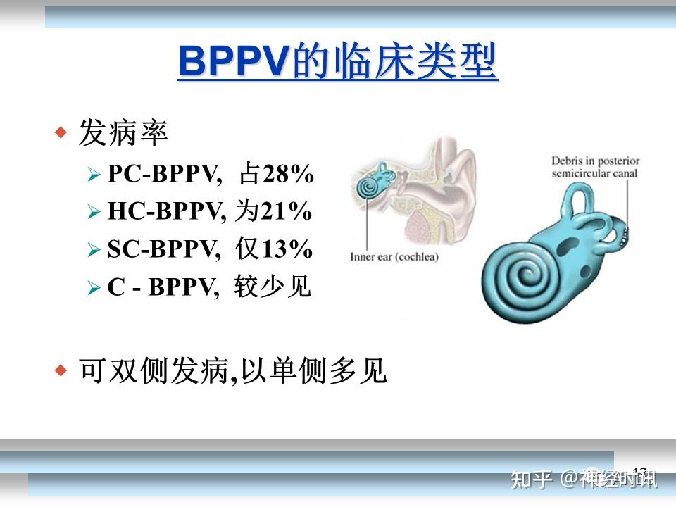 耳石症复位诊断和治疗【建议收藏】 - 知乎