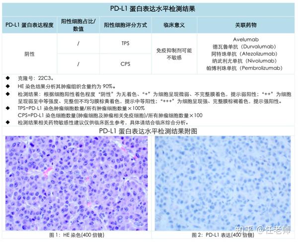 PDL-1，TMB，MSI 这些到底是什么？有什么意义？ - 知乎