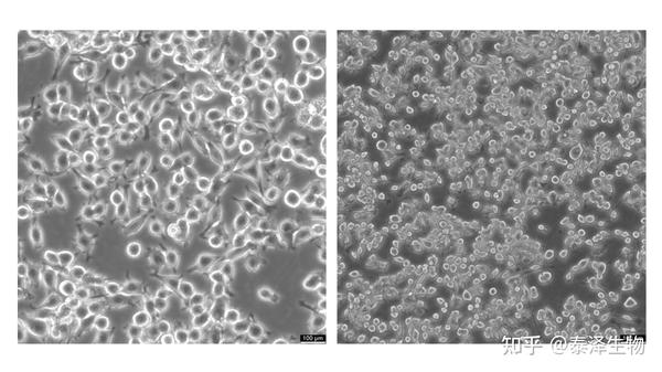 细胞进阶讲解—BV2 - 知乎