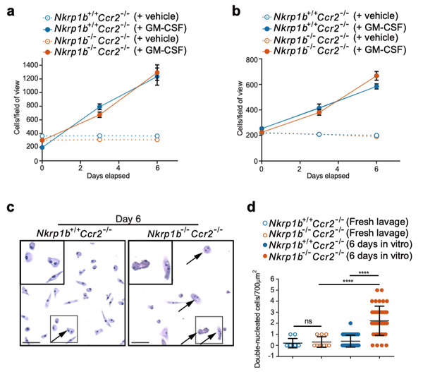 Nature子刊丨通过 C 型凝集素受体进行的肺泡巨噬细胞代谢编程可防止脂肪毒性和细胞死亡 - 知乎