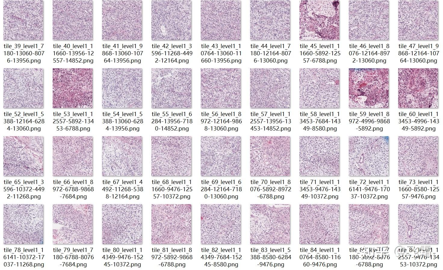 医学图像实战：病理学WSI图像的预处理 - 知乎