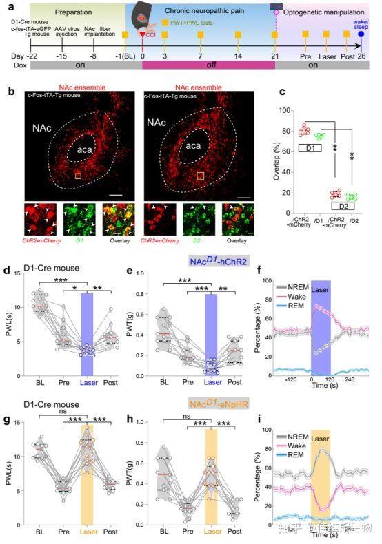 病毒示踪神经环路结合光遗传研究发现——疼痛和睡眠障碍具有相同的伏隔核神经调控机制 - 知乎
