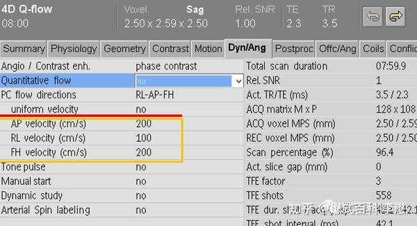 4D-Flow扫描数据采集：序列及参数 - 知乎