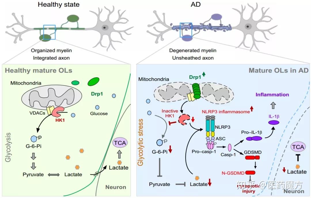阿尔茨海默症新靶点通路——Drp1-HK1-NLRP3 - 知乎