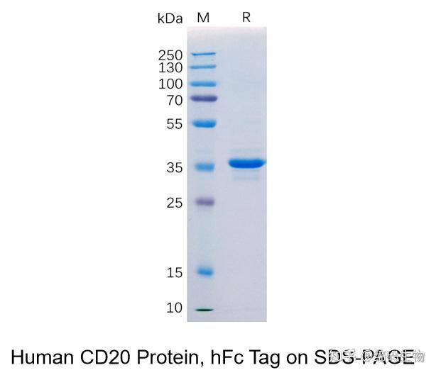 CD20:自身免疫疾病方向的研究进展 - 知乎