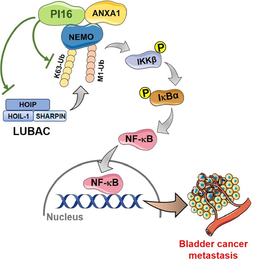广州医科大学附属肿瘤医院蒋丽丽/杨建安团队揭示PI16在抑制膀胱癌转移中的重要作用 - 知乎