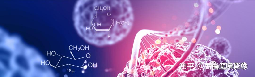 18F-FDG是什么？18F-FDG怎么标记病灶【高尚医学影像】 - 知乎