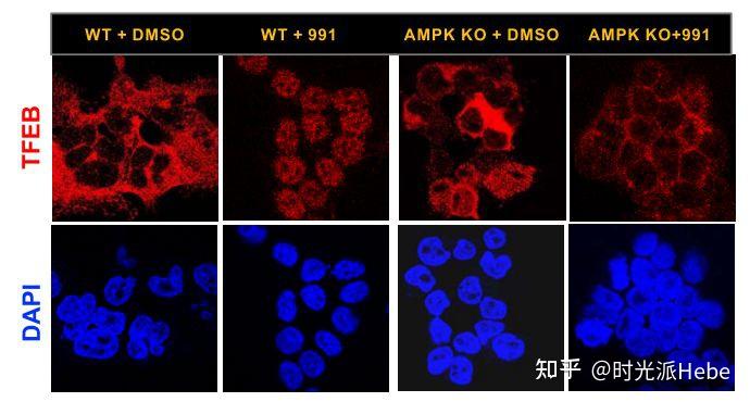 20年磨一剑！Science：索尔克研究所破解AMPK与线粒体合成关键蛋白 - 知乎