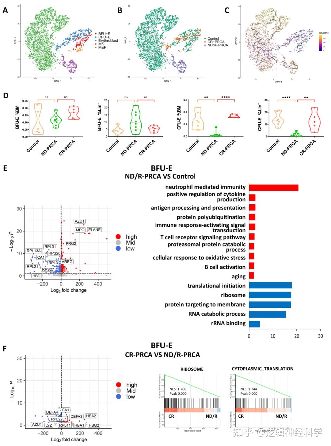 Genes Dis︱王化泉/蔡志刚团队通过单细胞转录组测序揭示了纯红细胞再生障碍性贫血中红系祖细胞的异常转录组特征 - 知乎