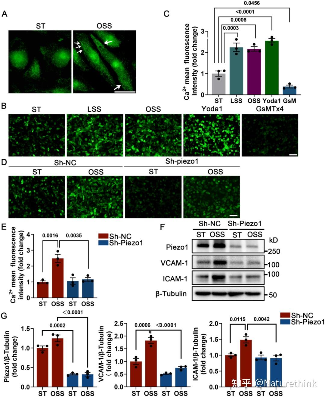 Piezo1 介导的机械转导导致血流紊乱诱导的动脉粥样硬化内皮炎症 - 知乎