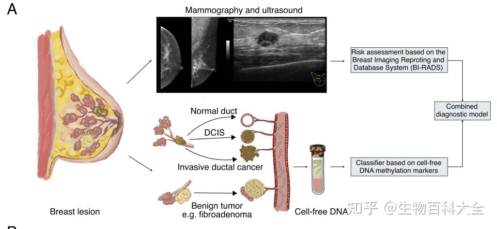 Mol Cancer. |乳腺癌中血浆cfDNA甲基化biomarkers结合成像技术可提升早诊准确率 - 知乎