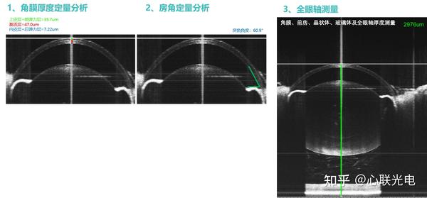 小动物眼轴及前节oct一体化成像系统 - 知乎