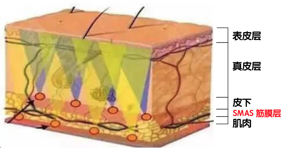 线雕的线PDO、PPDO、PLLA有啥区别？为什么这么多人想做线雕提升？ - 知乎
