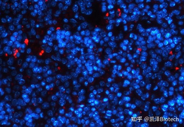 巨噬细胞M1.M2，历时2年硬干货分享. - 知乎