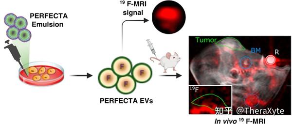 19F-磁共振成像用于外泌体示踪 - 知乎