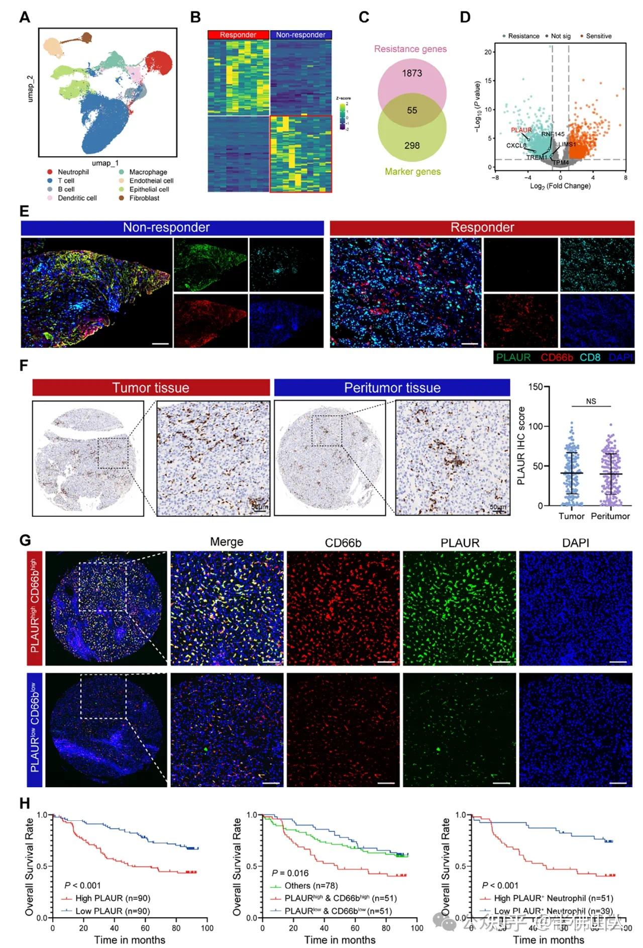 最新14+生信，单细胞识别PLAUR+中性粒细胞塑造免疫抑制微环境，抑制PLAUR 增强抗 PD1 疗效。高分文章经典思路！ - 知乎