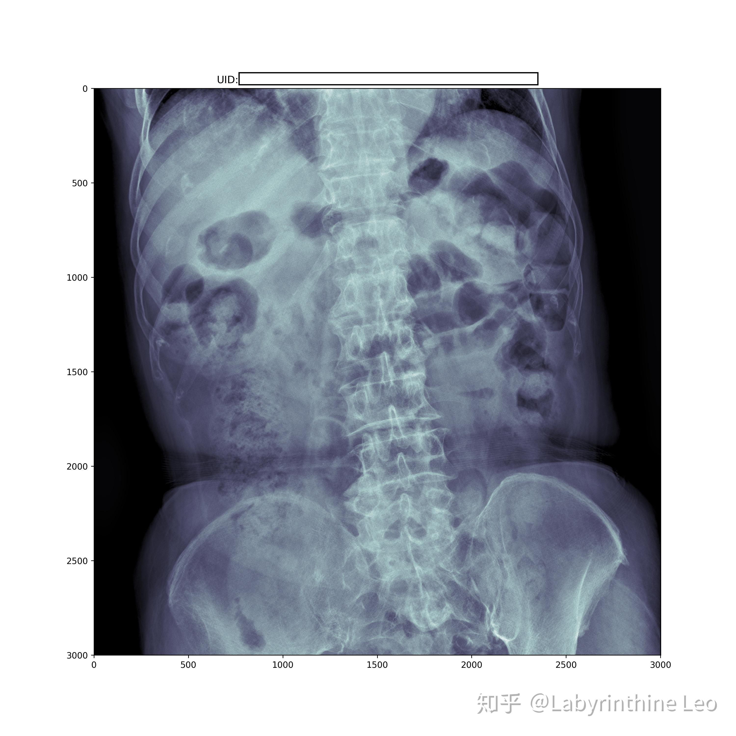 初始DICOM以及pydicom的基础操作 - 知乎