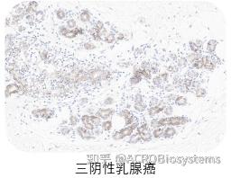 【IHC精准检测】——三阴性乳腺癌伴随诊断关键抗体：TROP-2 - 知乎